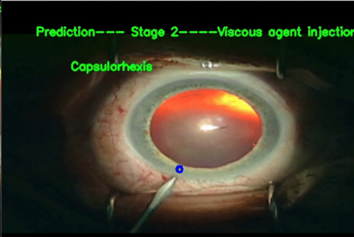 CataGuide-Net · ARIS AI Lab